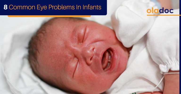 9 Common Eye Problems In Infants | Child Care, Eyes and Vision | oladoc.com